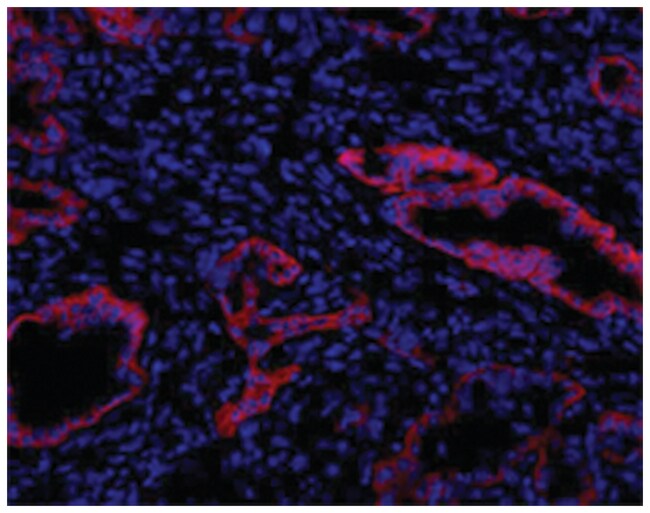 OVAL CELL MARKER MAB