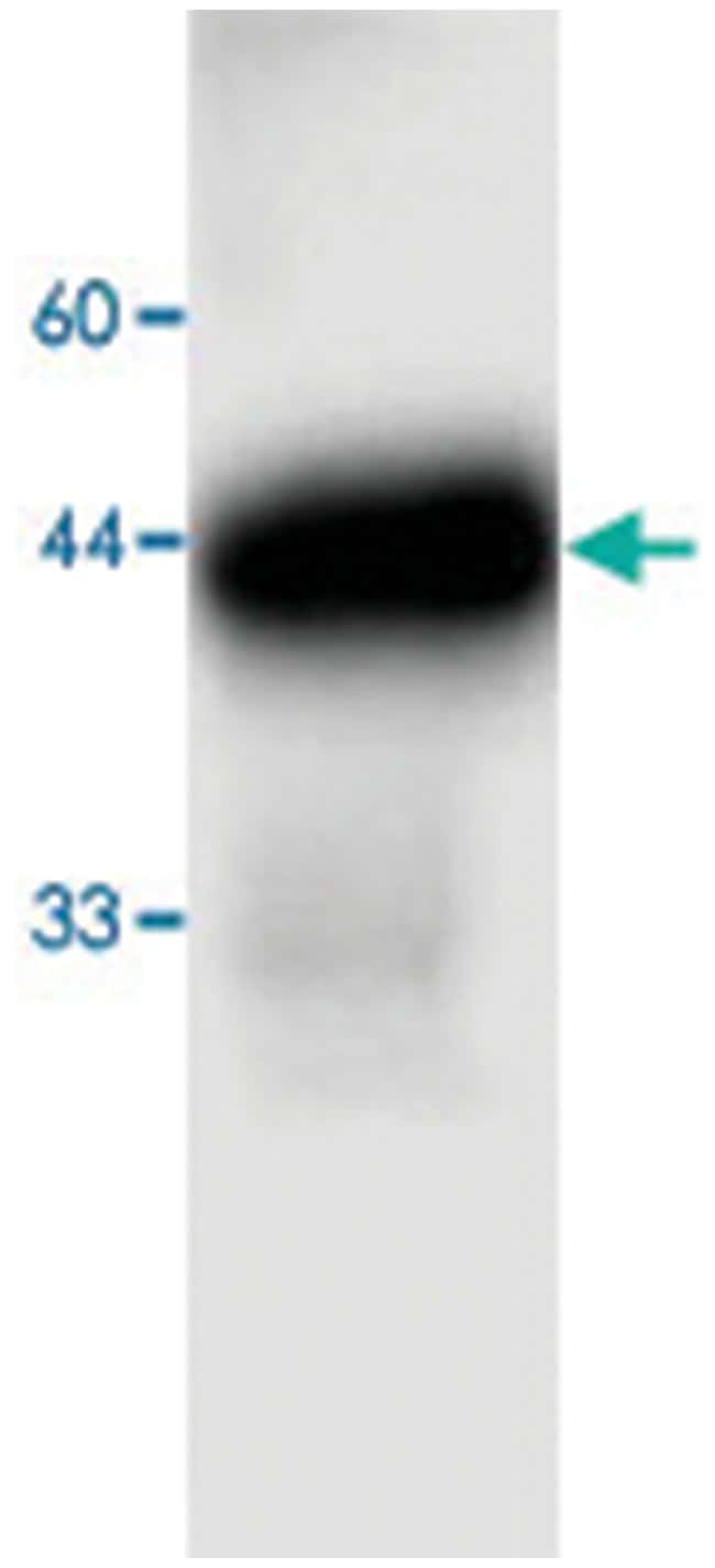 ANTI-PRDX5 ANTIBODY 100UL