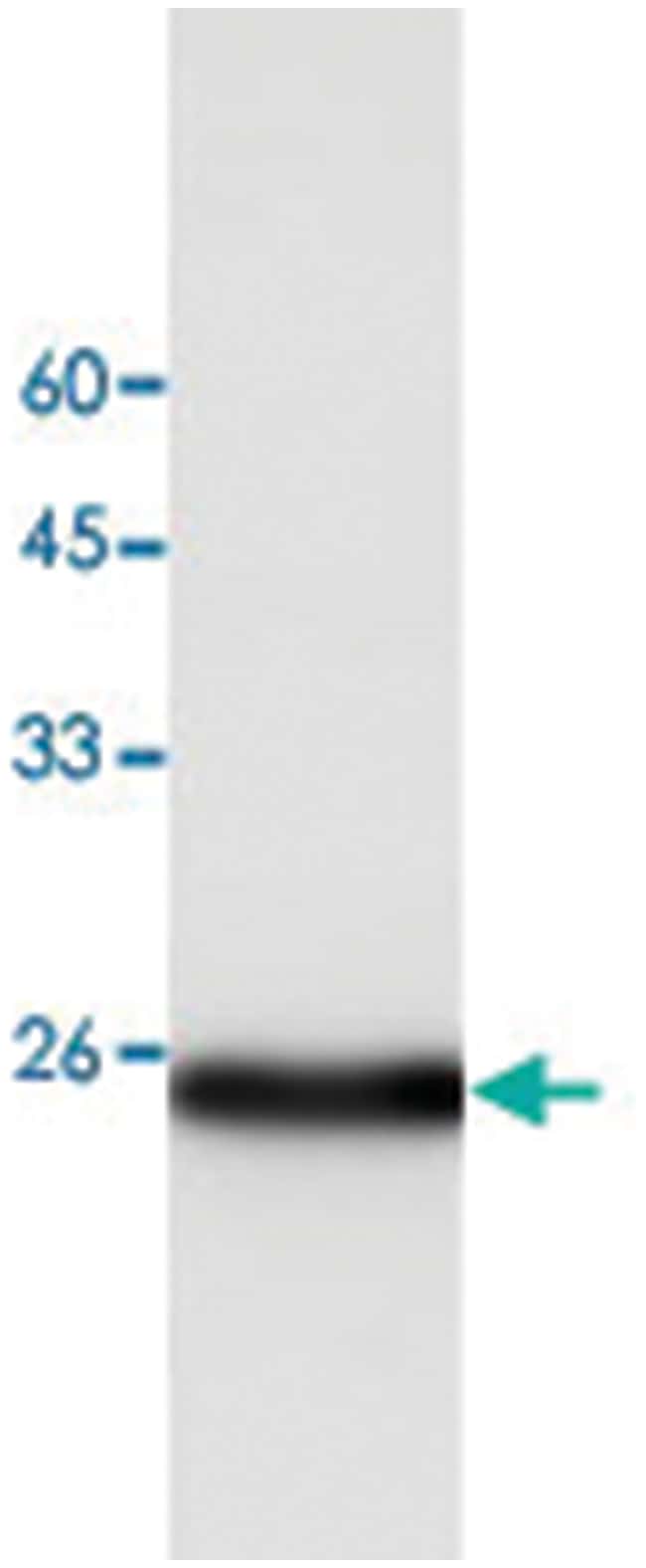 ARHGDIB, Mouse, Clone: 16, Abnova 100μg; Unlabeled:Antibodies, Monoclonal | Fisher Scientific