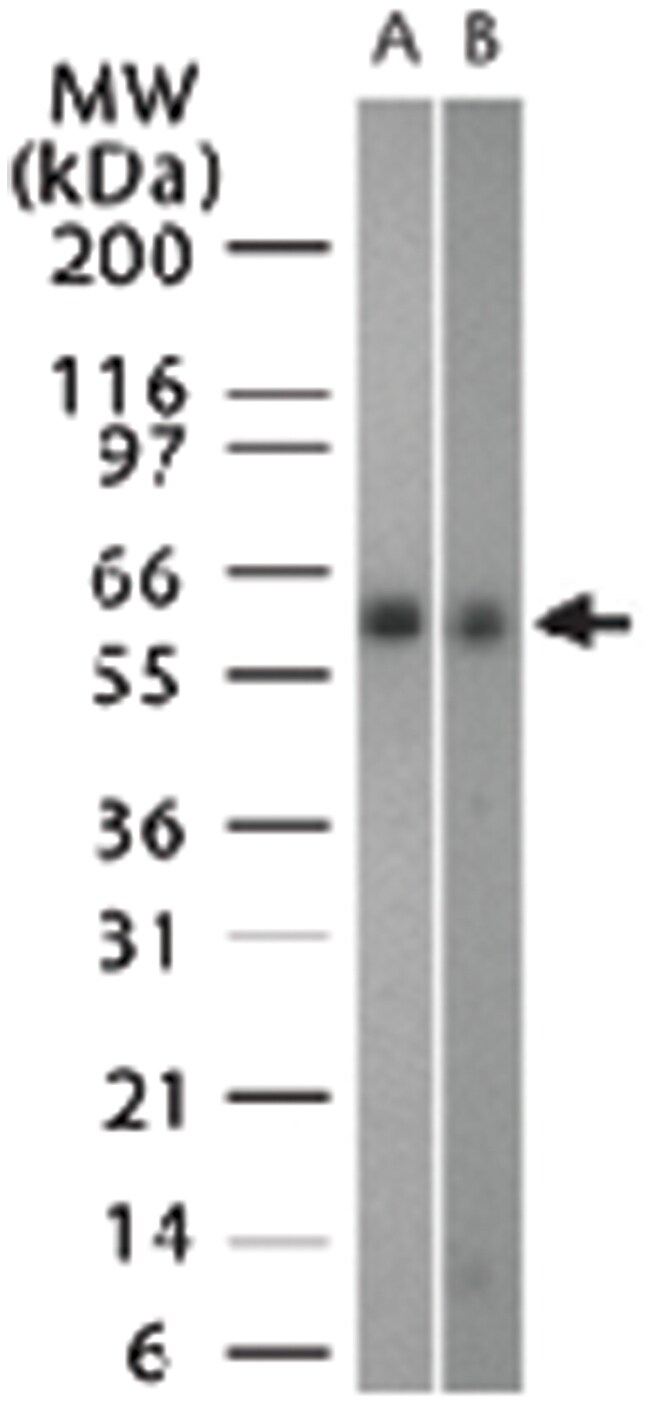 ANTI-ASB2 ANTIBODY 200UL