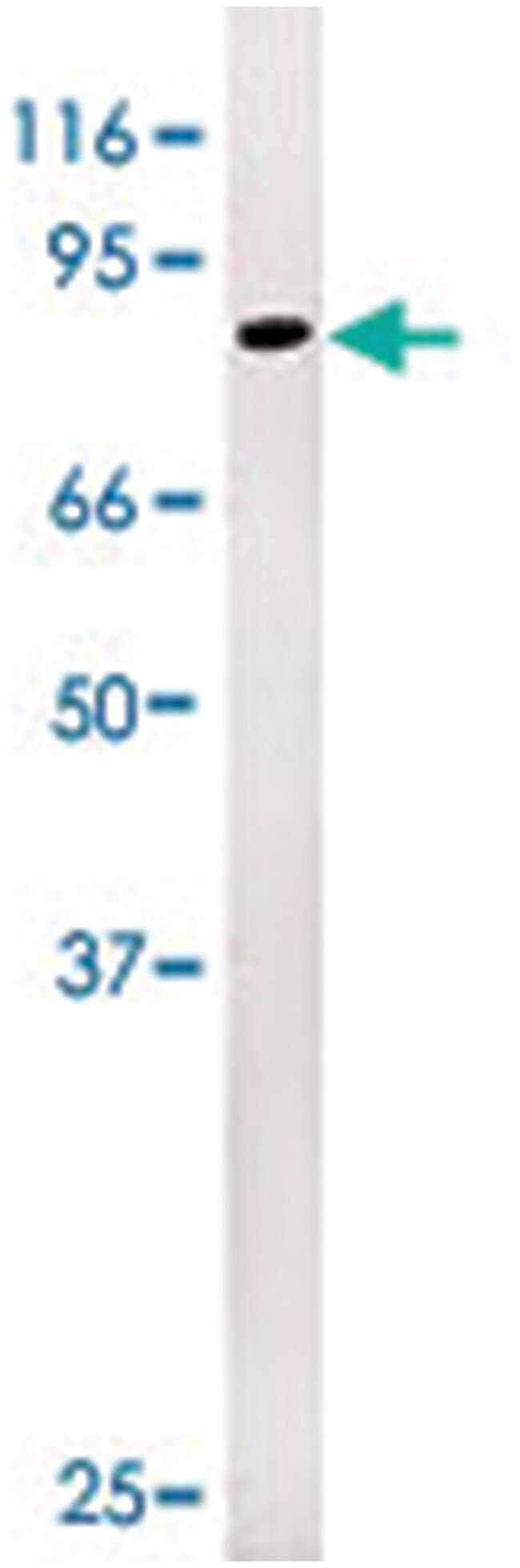 RB1 (phospho S249), Rabbit anti-Human, Polyclonal Antibody, Abnova ...