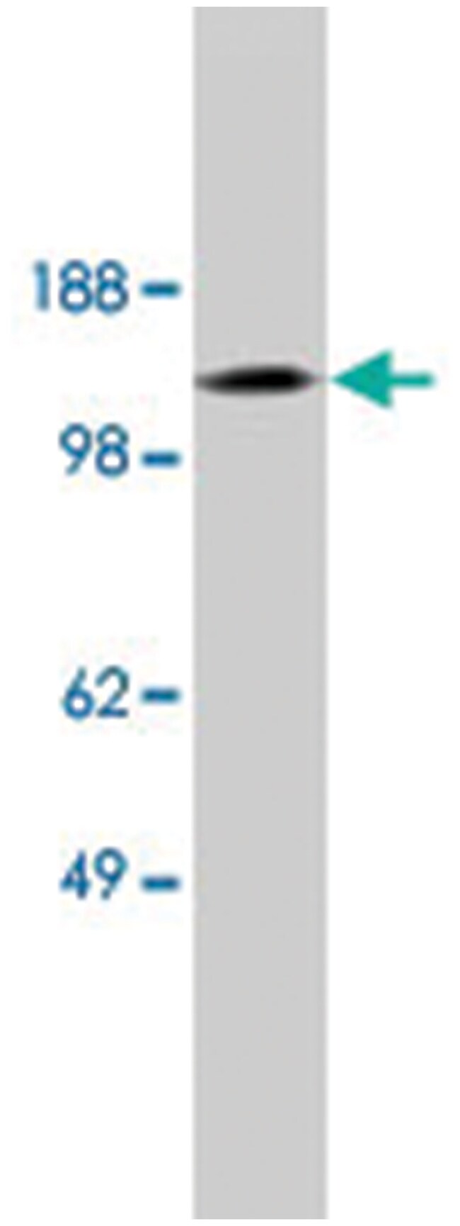 ANTI-SLC9A6 ANTIBODY 100UG