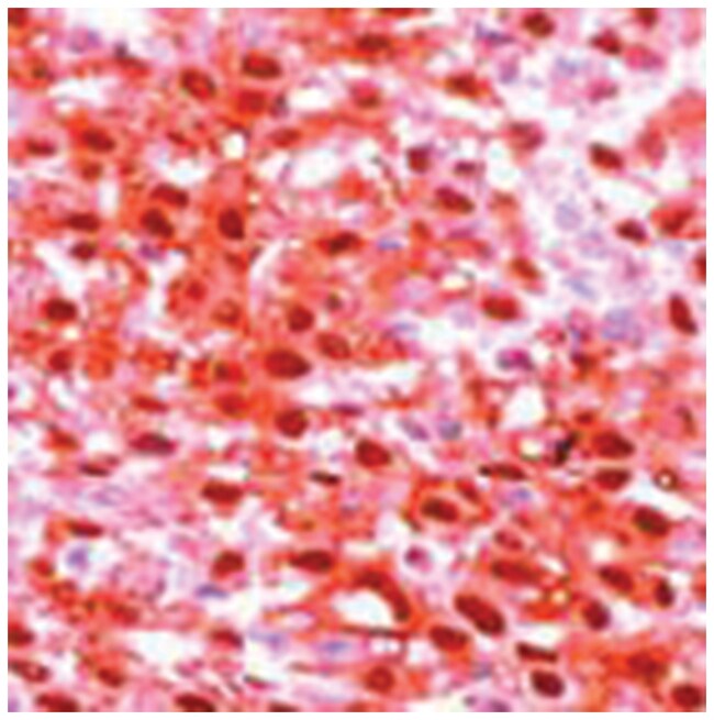 Calb2, Rabbit, Polyclonal Antibody, Abnova 100μL; Unlabeled:Antibodies ...