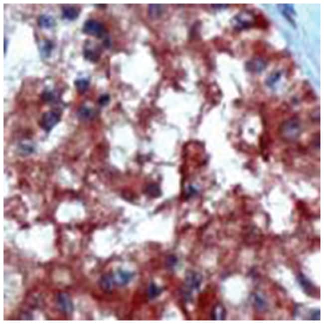 ANTI-INHA ANTIBODY 100UL