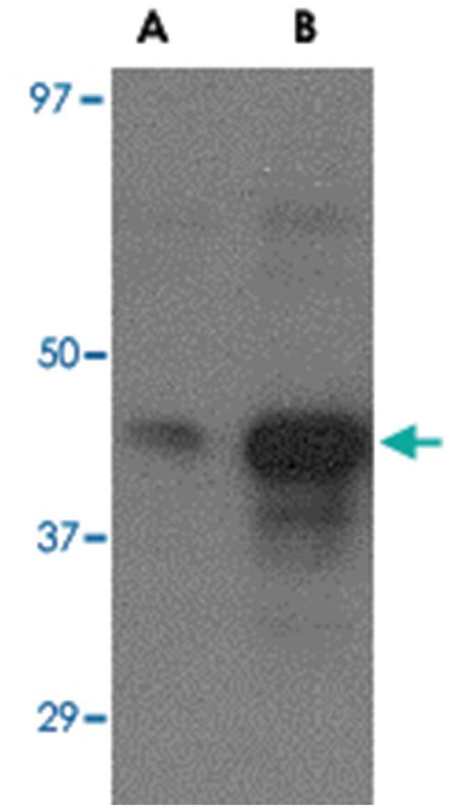 Avian Influenza Hemagglutinin 3, Goat, Polyclonal Antibody, Abnova ...