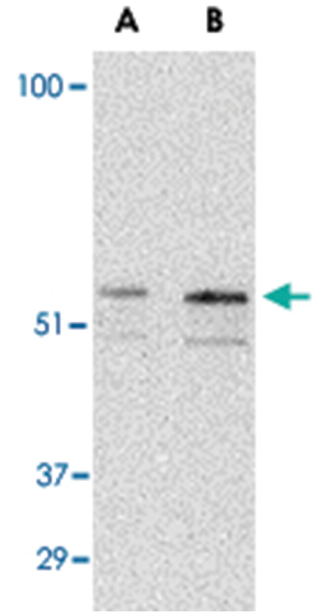 ANTI-PAK2 ANTIBODY 100UG