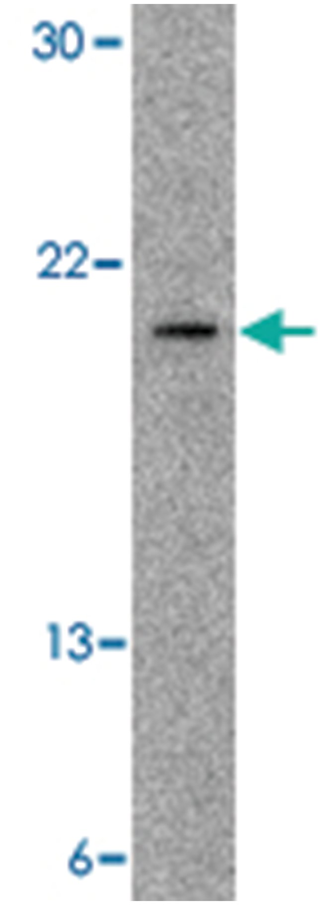 ANTI-SLPI ANTIBODY 100UG