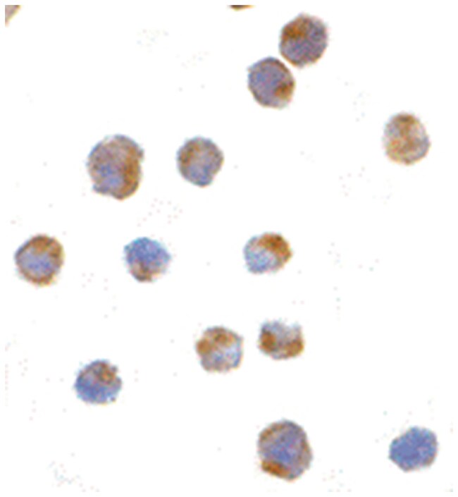 ERN1 Rabbit anti-Human, Mouse, Rat, Polyclonal Antibody, Abnova 100μg ...