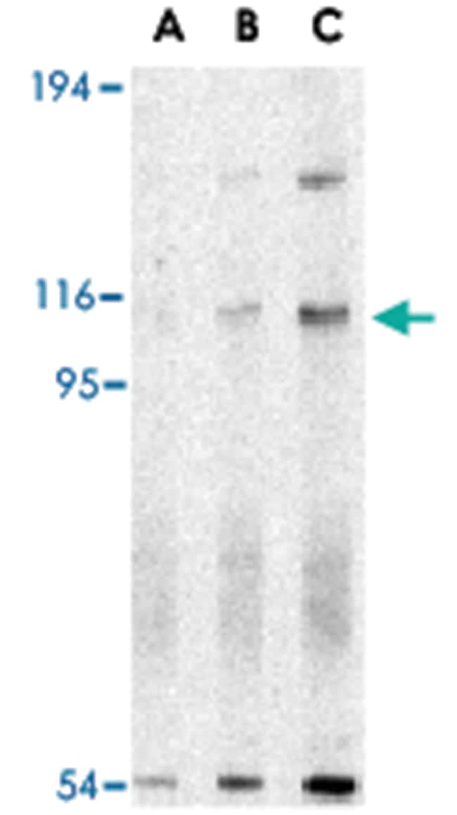 ERN1 Rabbit anti-Human, Mouse, Rat, Polyclonal Antibody, Abnova 100μg ...