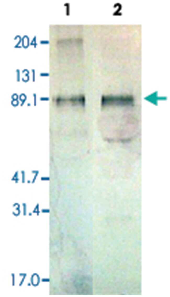 ANTI-THPO ANTIBODY 1MG