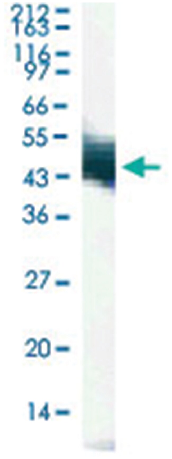 ANTI-IKBKG ANTIBODY 100UG