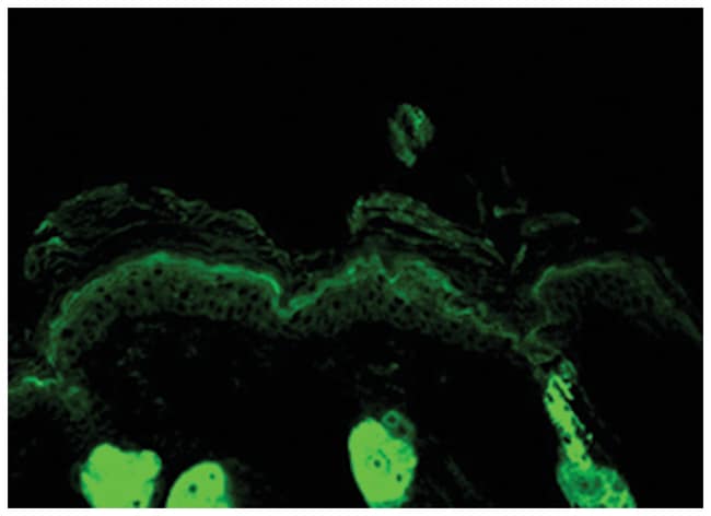 ANTI-CALR ANTIBODY 200UL