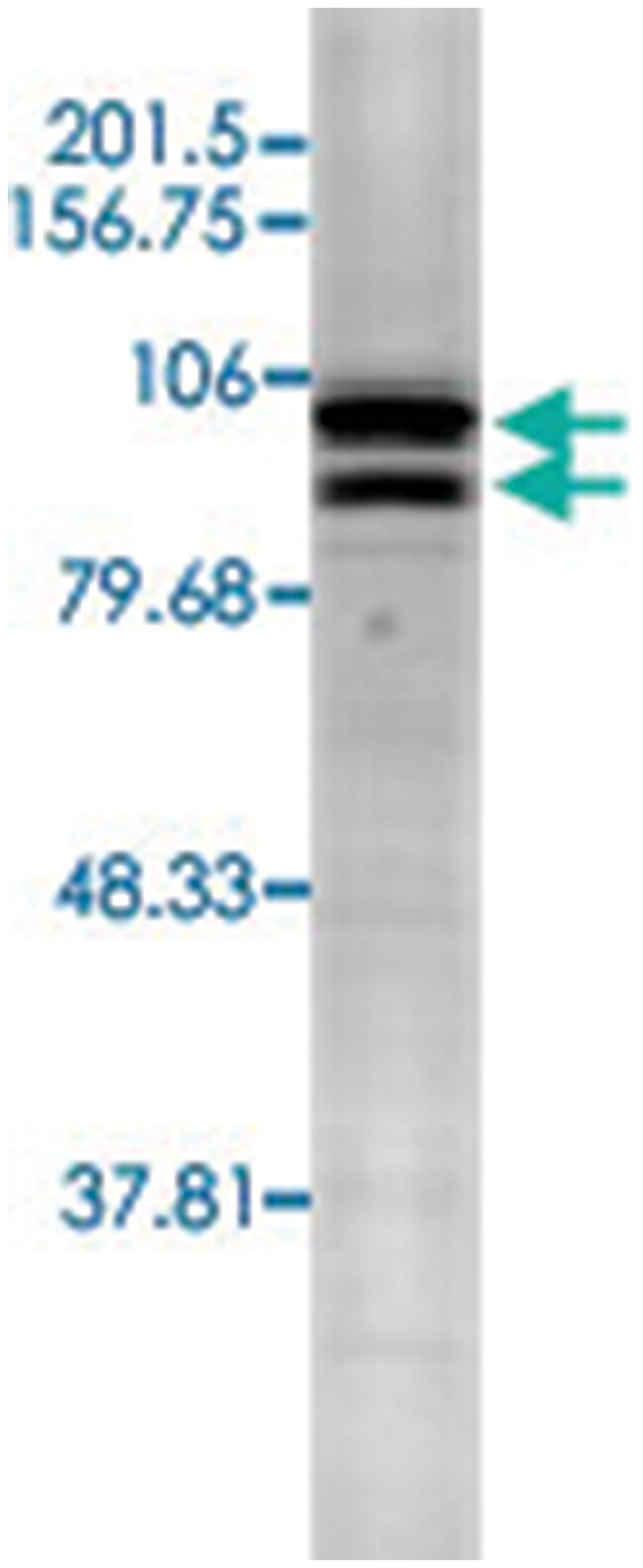 ANTI-CANX ANTIBODY 200UG
