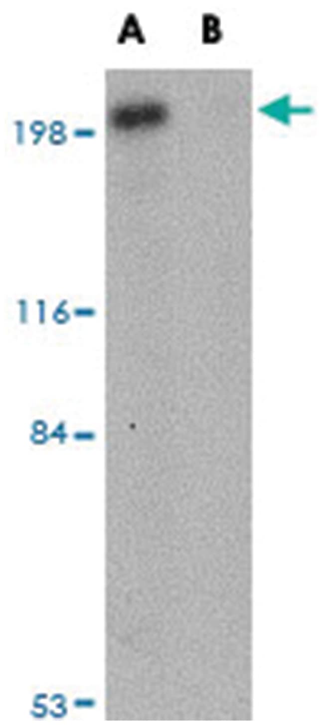 ANTI-ITGA4 ANTIBODY 100UG