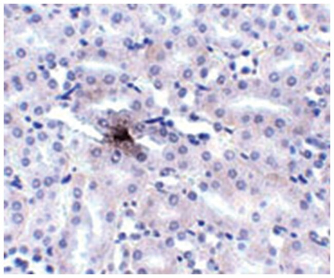 SLC39A11, Rabbit, Polyclonal Antibody, Abnova 100µg; Unlabeled:Life ...