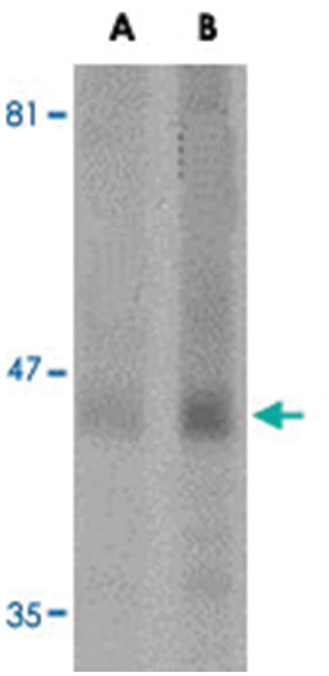 ANTI-PLEKHO1 ANTIBODY 100UG