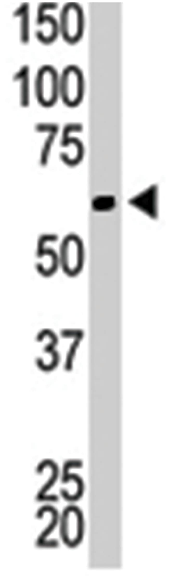 ANTI-CBX4 ANTIBODY 400UL