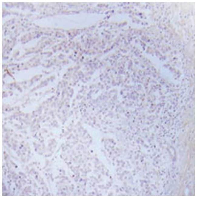 IKK-alpha/beta (phospho S176), Rabbit anti-Human, Mouse, Rat, Polyclonal | Fisher Scientific