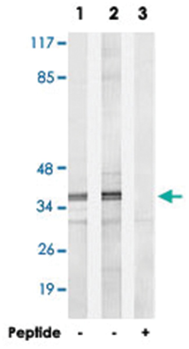 ANTI-PSMD11 ANTIBODY 100UG