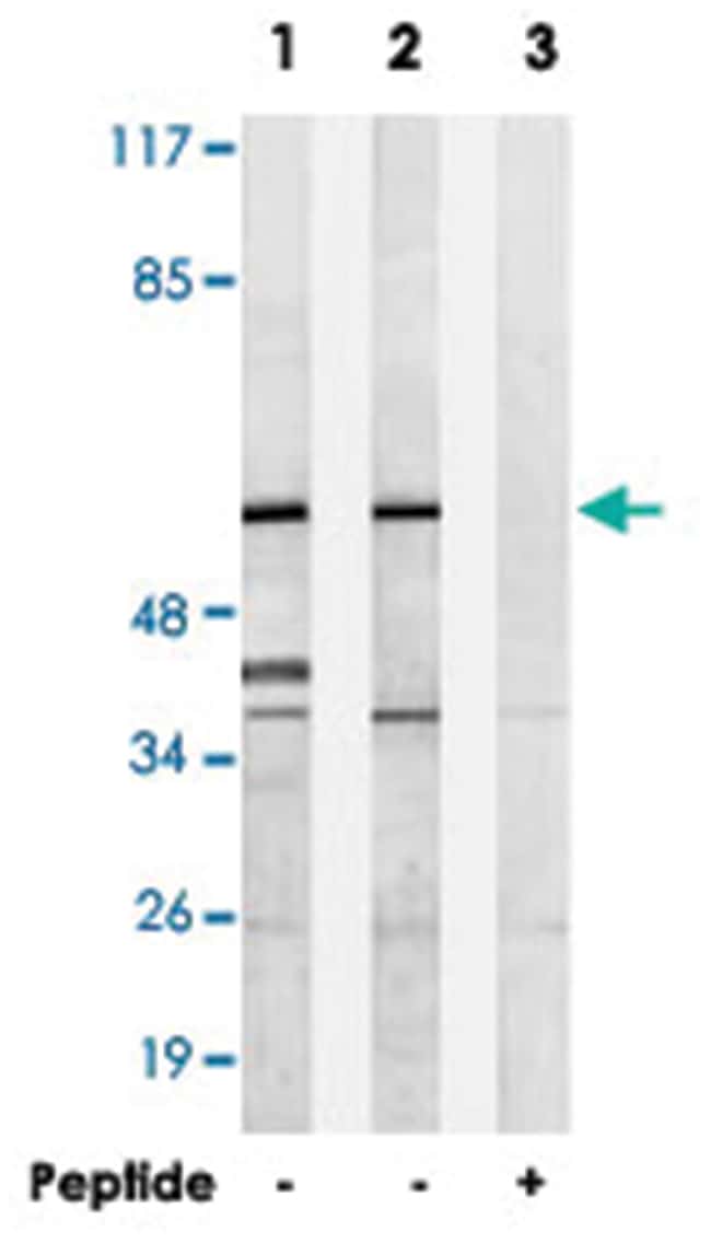 ANTI-GBP3 ANTIBODY 100UG