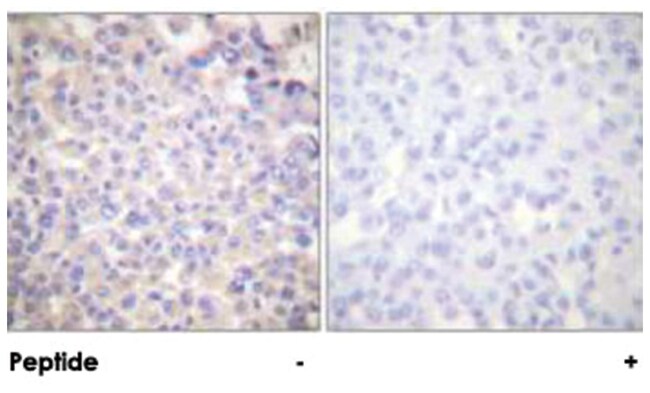 ANTI-PLCG2 ANTIBODY 100UG