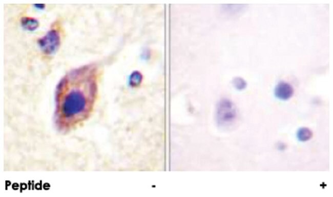 ANTI-PLCG2 ANTIBODY 100UG