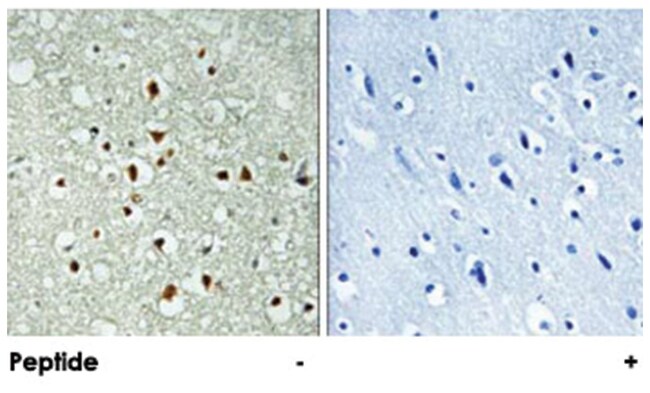 ANTI-MAX ANTIBODY 100UG