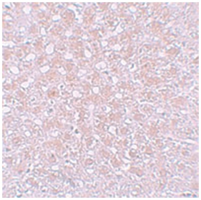AFP Rabbit anti-Human, Mouse, Rat, Polyclonal Antibody, Abnova 100μg ...
