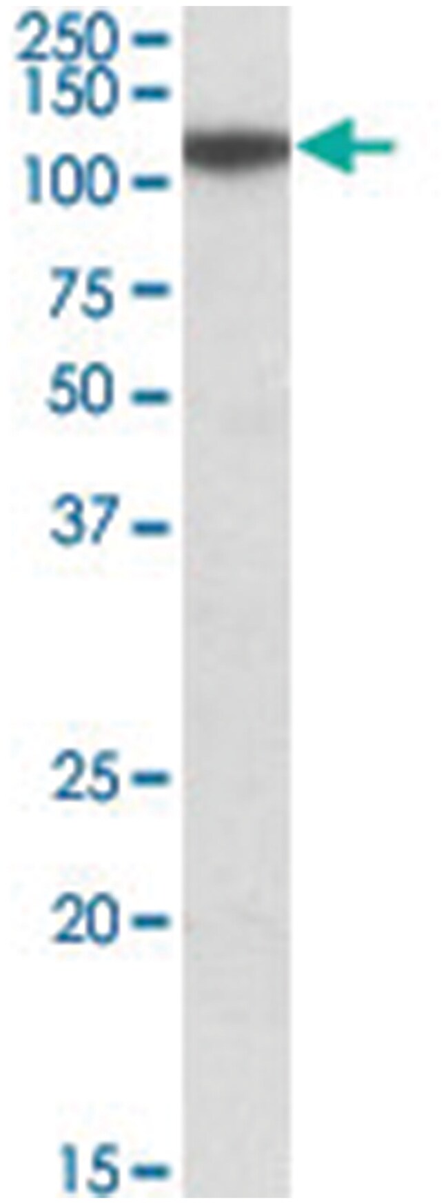 MTHFD1L, Goat, Polyclonal Antibody, Abnova 100μg; Unlabeled:Antibodies ...