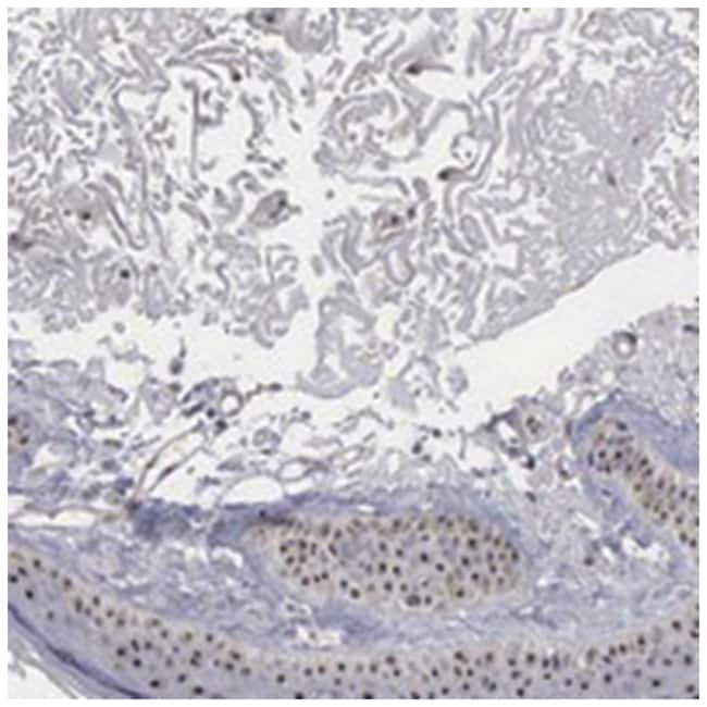 ANTI-NGDN ANTIBODY 100UL