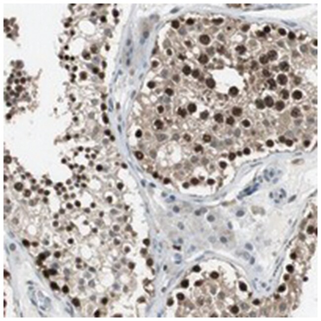 ANTI-MAFB ANTIBODY 100UL