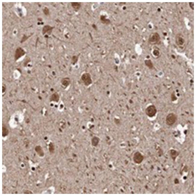 ANTI-SEZ6 ANTIBODY 100UL