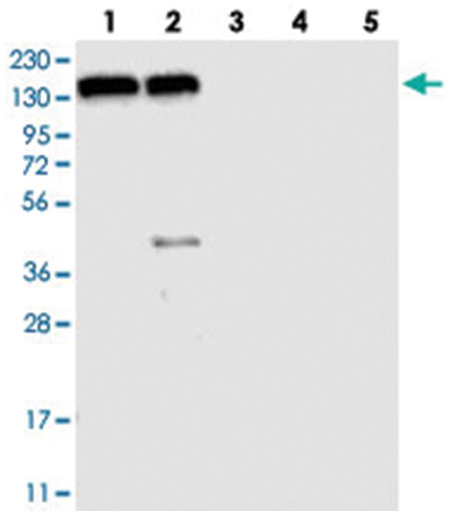 ANTI-FAM120A ANTIBODY 100UL