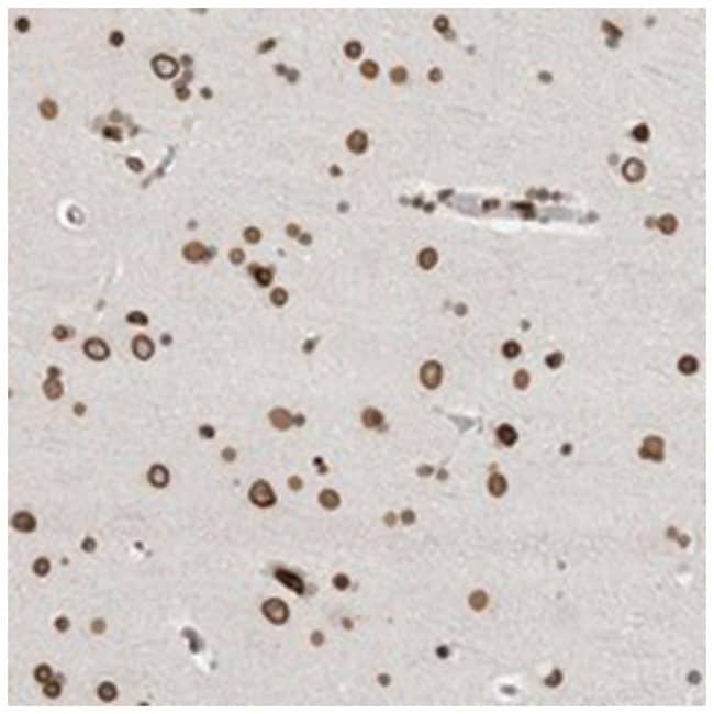 ANTI-CDCA2 ANTIBODY 100UL