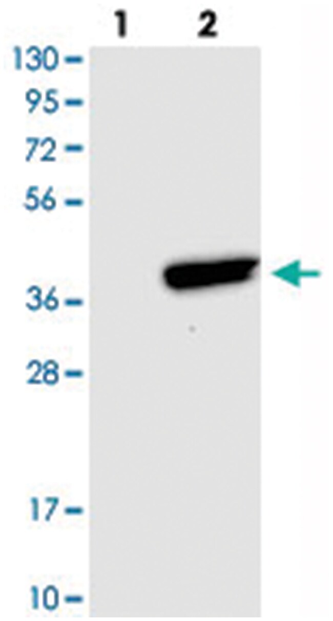 ANTI-RWDD2A ANTIBODY 100UL