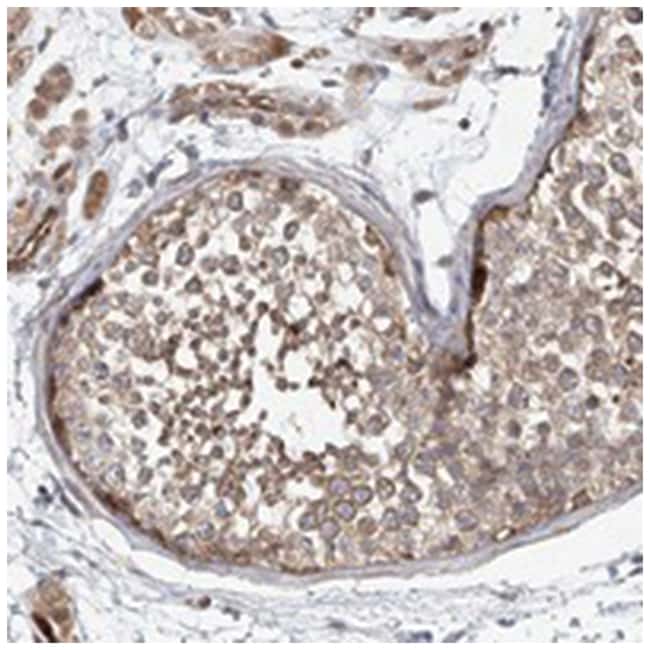ANTI-FRYL ANTIBODY 100UL