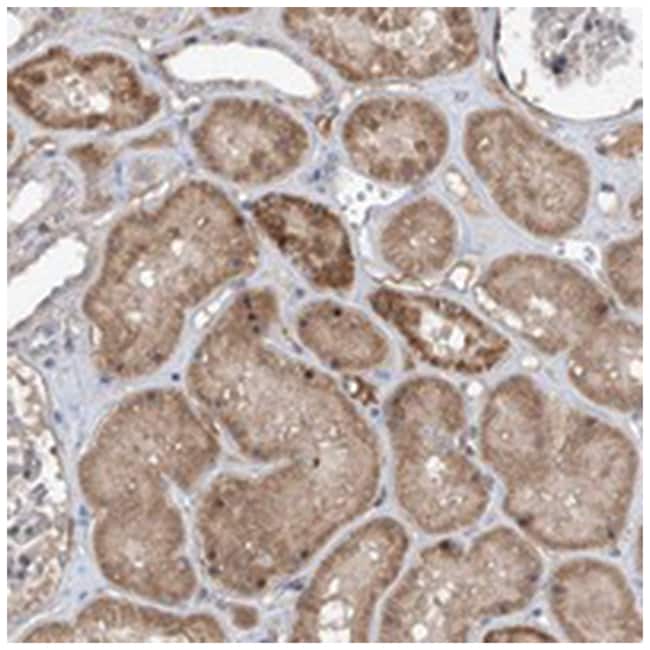 ANTI-FAM135A ANTIBODY 100UL