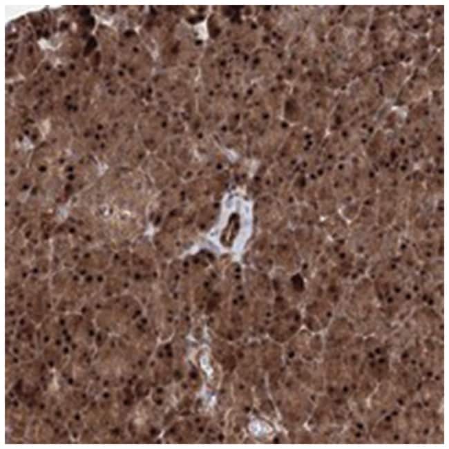 ANTI-ANKAR ANTIBODY 100UL
