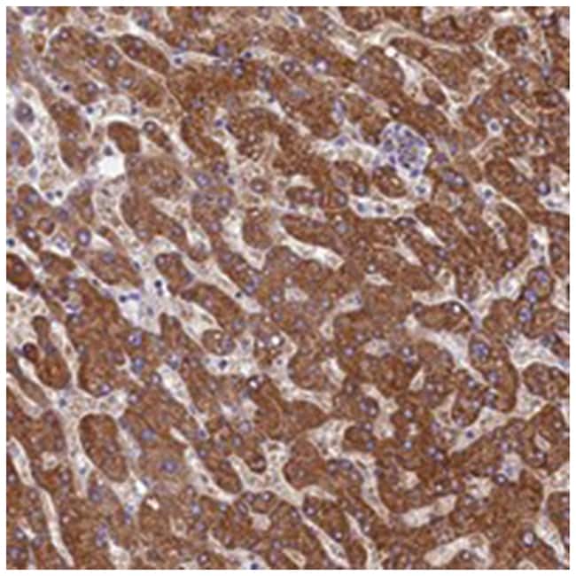 ANTI-SCD5 ANTIBODY 100UL