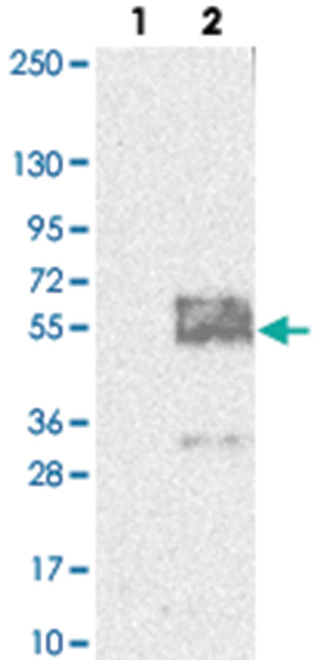MFSD8, Rabbit, Polyclonal Antibody, Abnova 100μL; Unlabeled:Antibodies ...