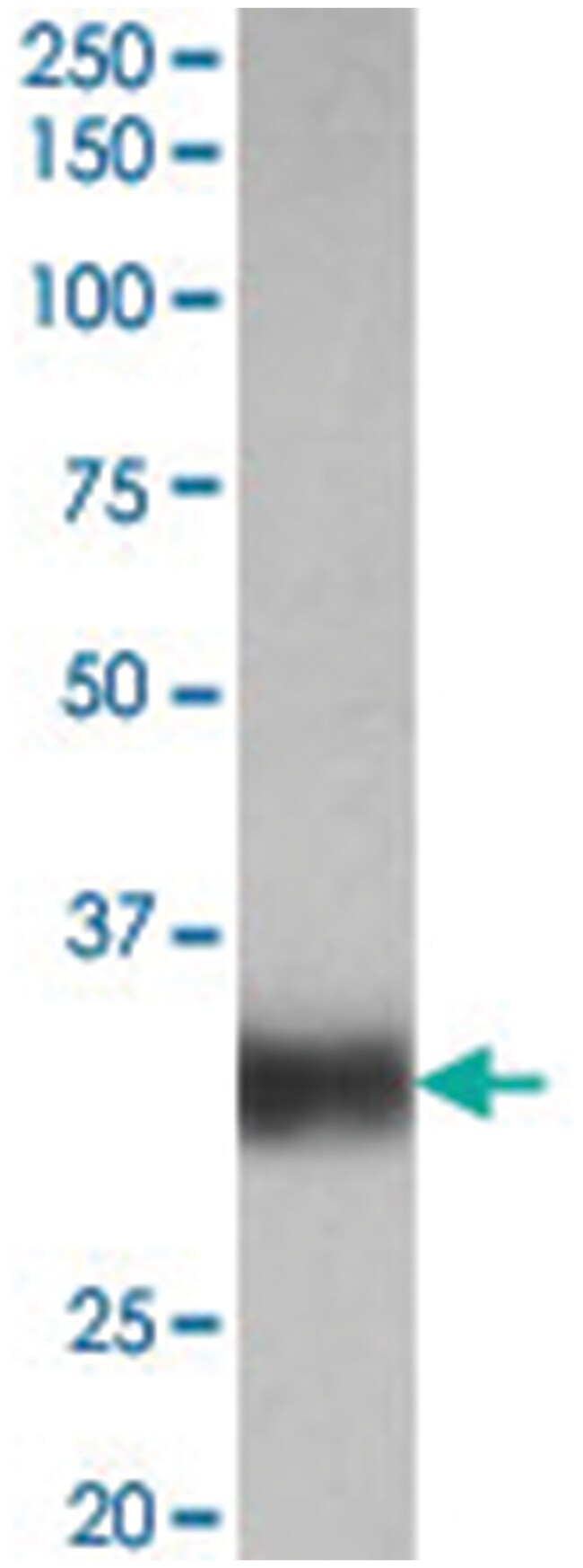 SFTPA1/SFTPA2, Goat, Polyclonal Antibody, Abnova 100μg; Unlabeled ...