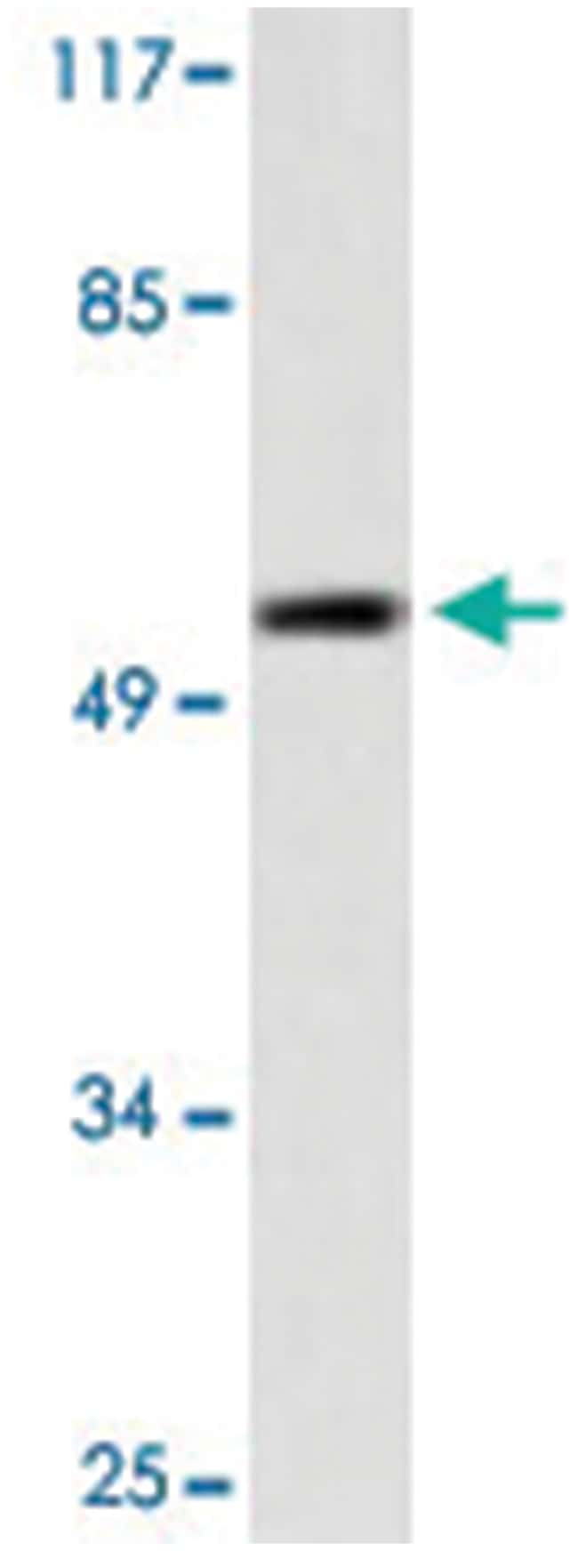 ANTI-TFDP1 ANTIBODY 100UL