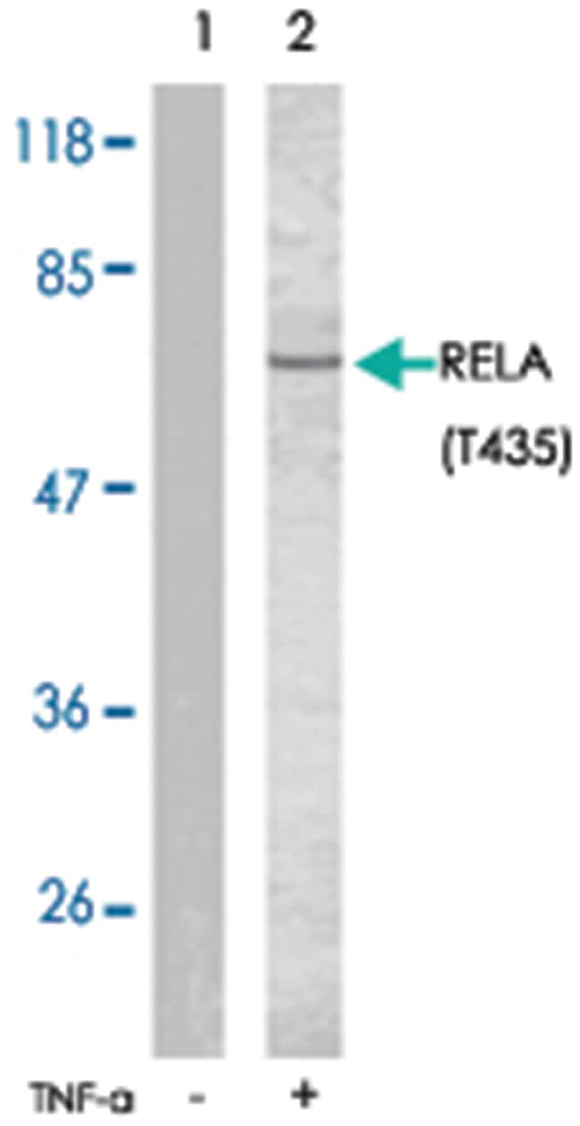 ANTI-RELA ANTIBODY 100UG