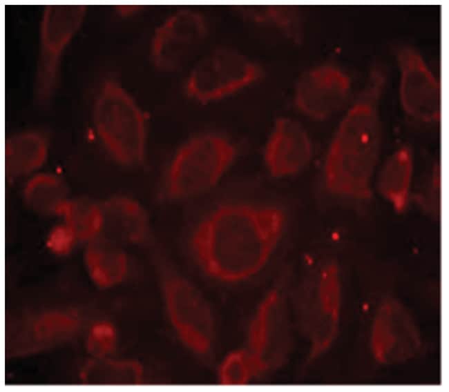 ANTI-RELA ANTIBODY 100UG