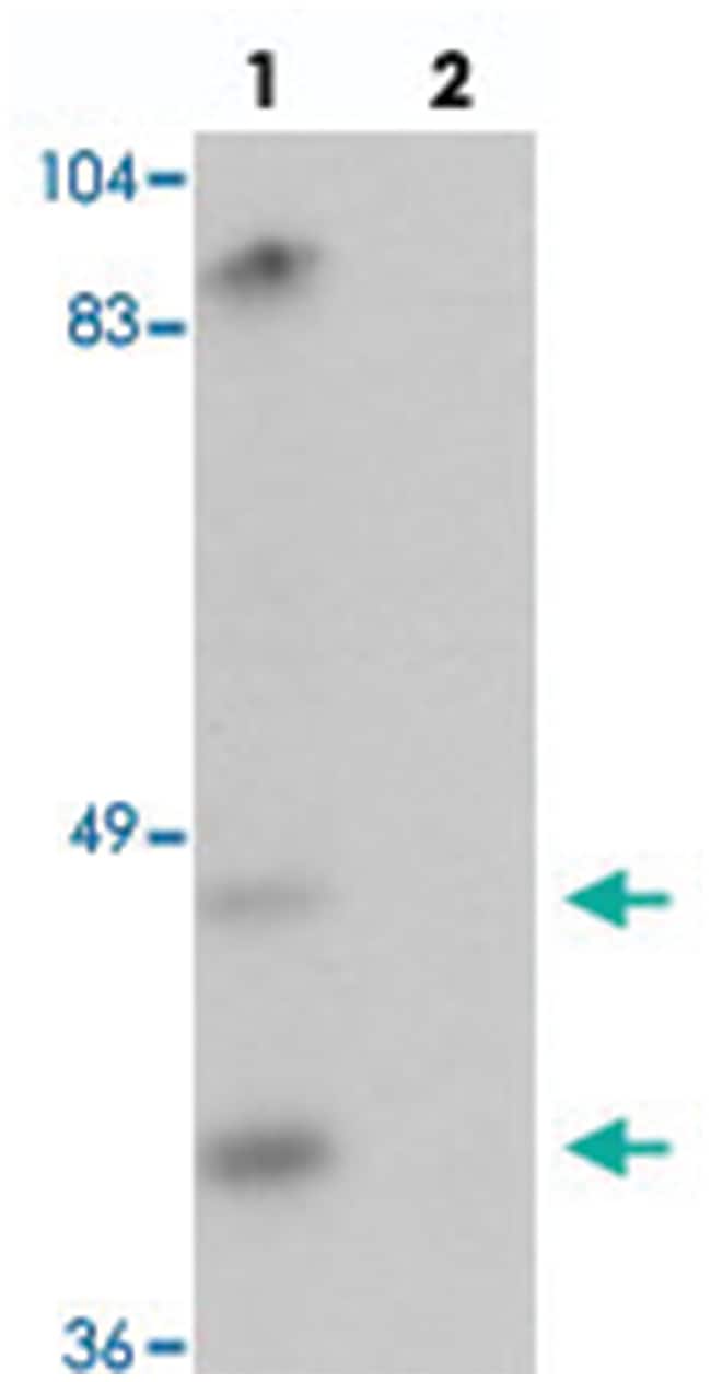 ANTI-TMPRSS11A ANTIBODY 100UG