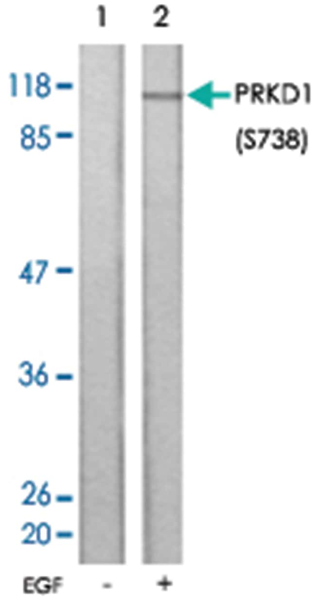 ANTI-PRKD1 ANTIBODY 100UG