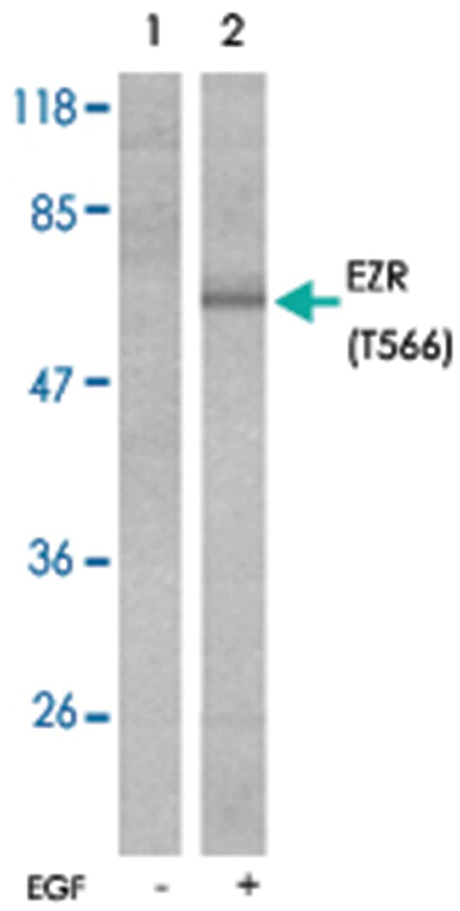 ANTI-EZR ANTIBODY 100UG