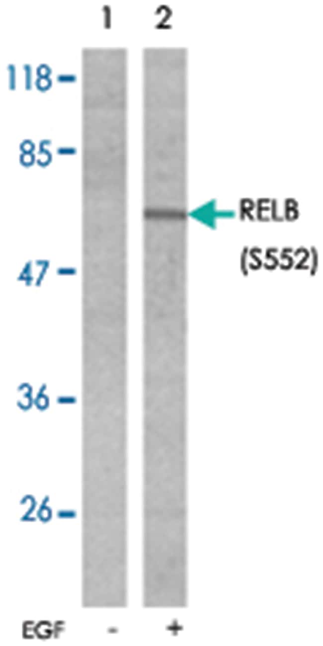 ANTI-RELB ANTIBODY 100UG