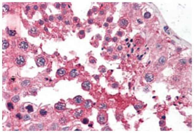 ANTI-GPC4 ANTIBODY 50UG