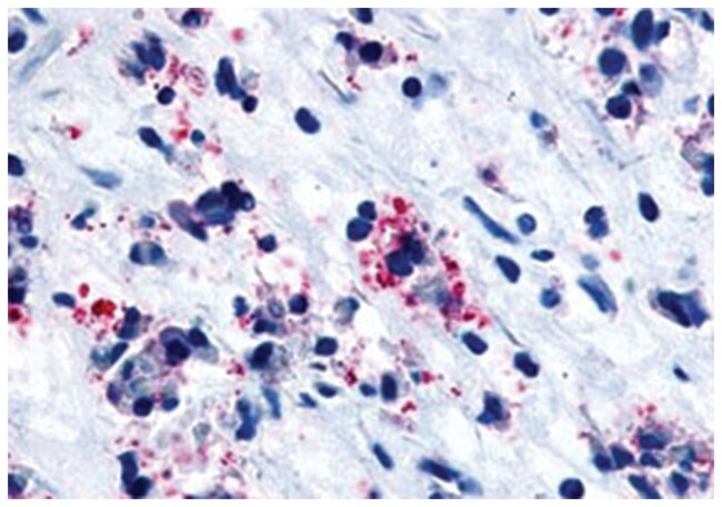 ANTI-CYSLTR1 ANTIBODY 50UG